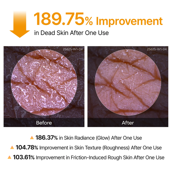 Peel Shot Kojic Acid Turmeric Duo – Dr. Melaxin